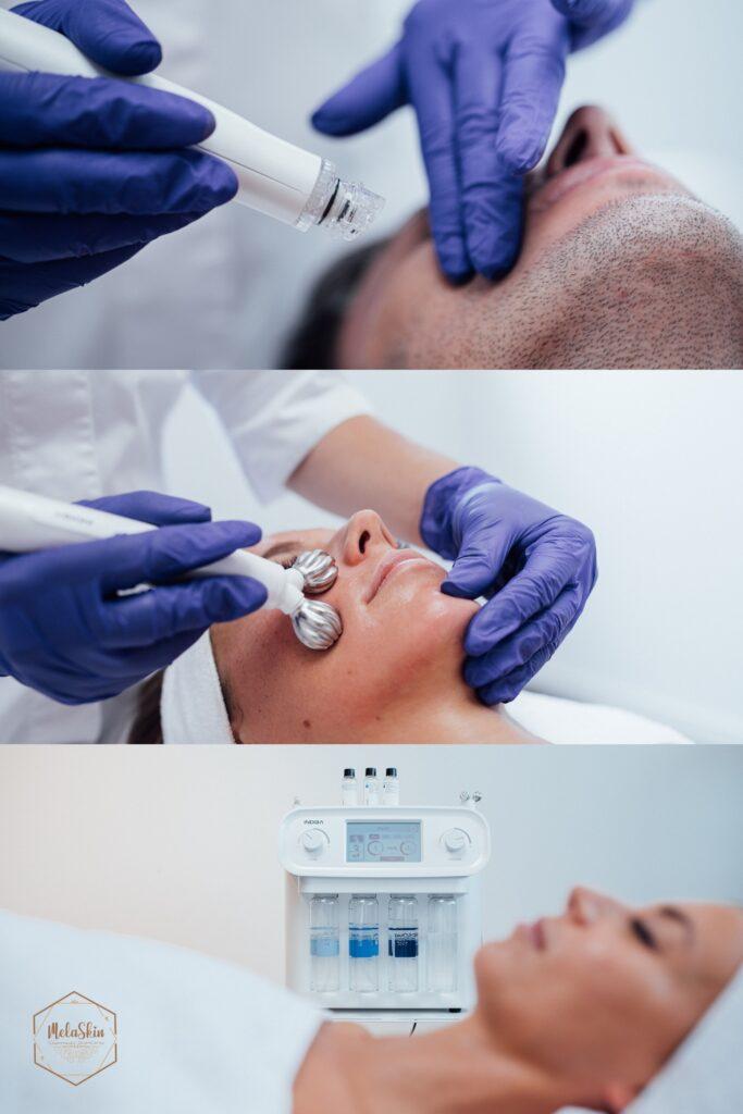 ONA Hydrofacial - MelaSkin